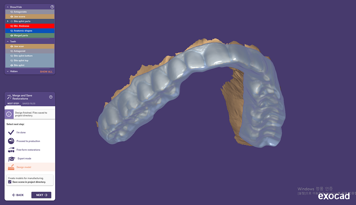 Week 6 Day 1: Orthodontic Theories and Nightguard Design | by Jung Lee ...