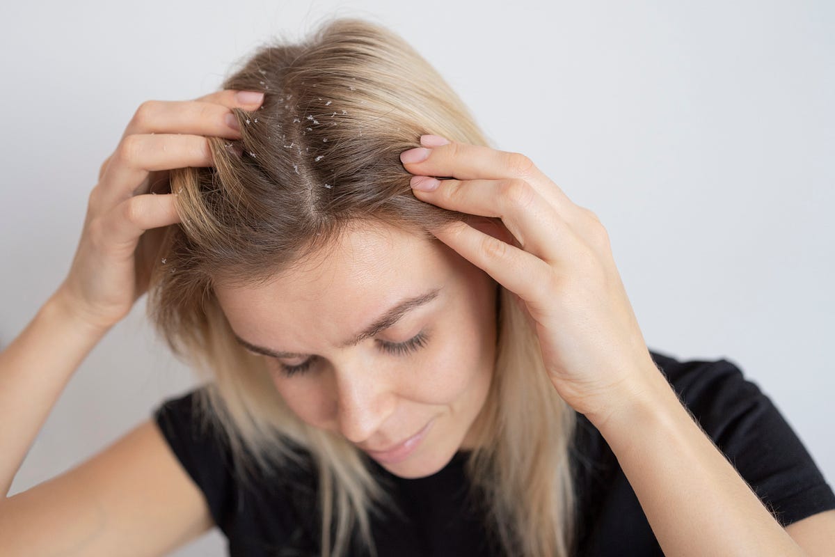 Why do dandruff and flakiness increase in summer? | by Perenne ...