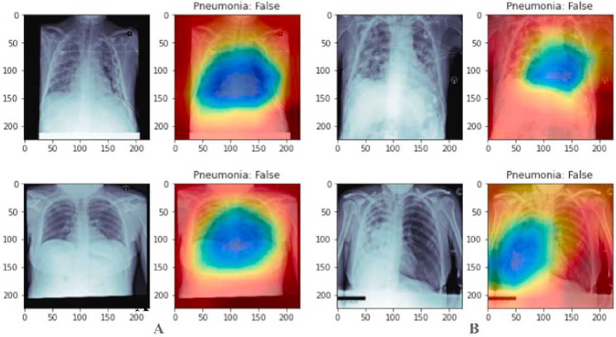 Data Leakage in Machine Learning with Hidden X-Ray Hack | by G e o r g ...