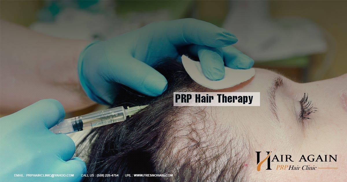 5 FACTS YOU NEED TO KNOW ABOUT PLATELET RICH HAIR PLASMA THERAPY | by ...