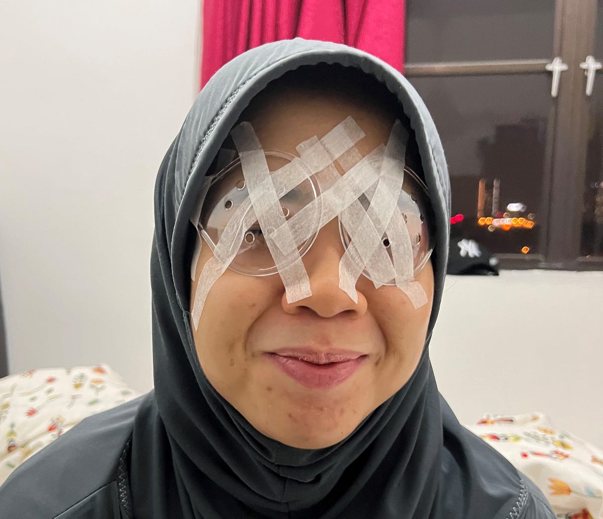 My Laser Vision Correction Experience — ASA (Advanced Surface Ablation ...