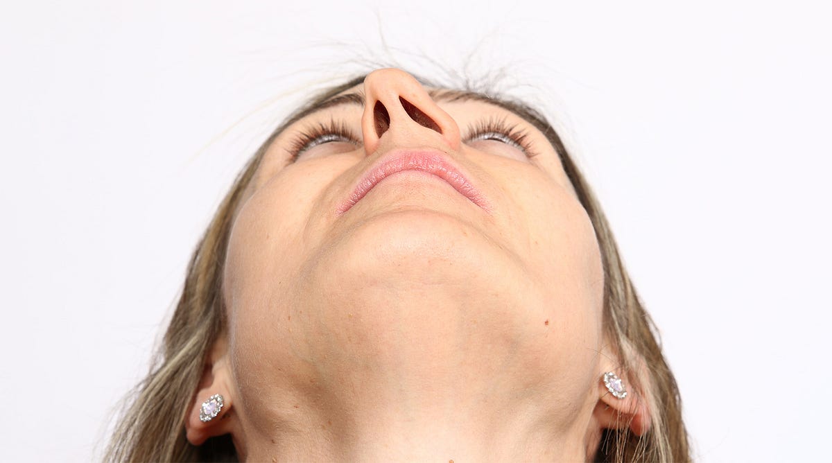 Are you having a crooked nose? Go for Septoplasty | by Mubashira Shahid ...