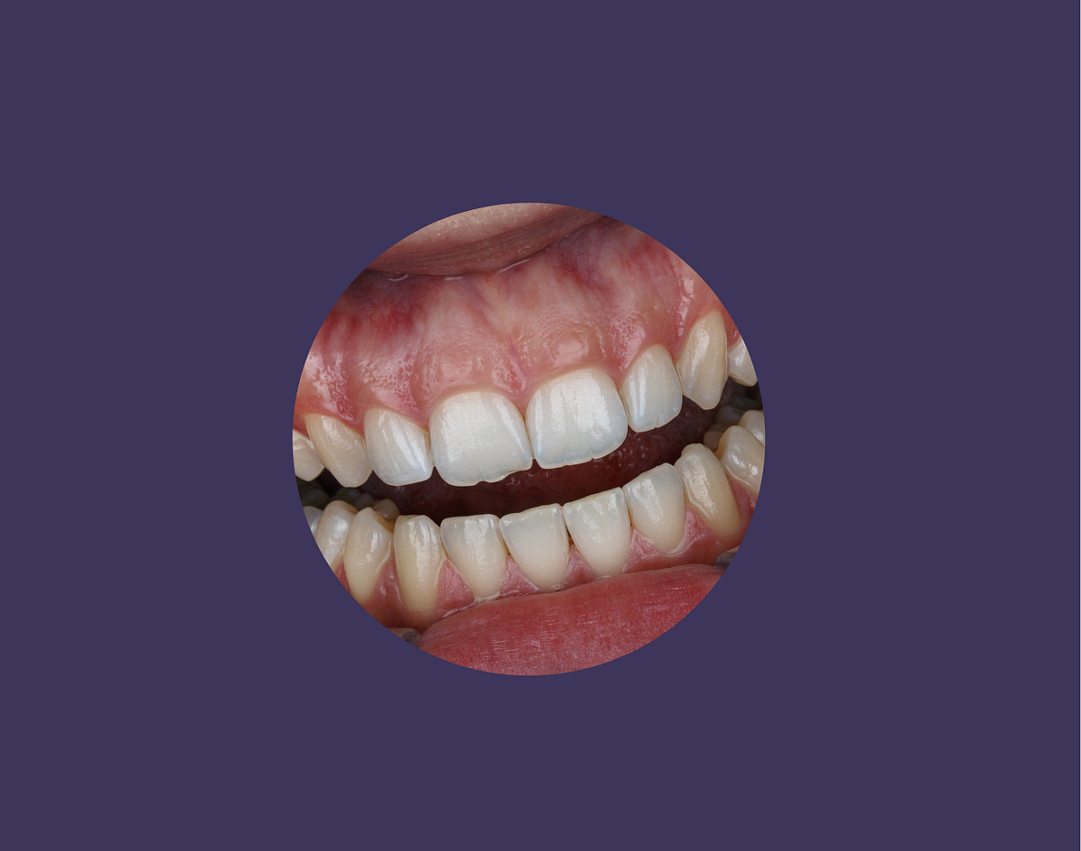 Maintaining great oral health. Since our oral health is a window to ...