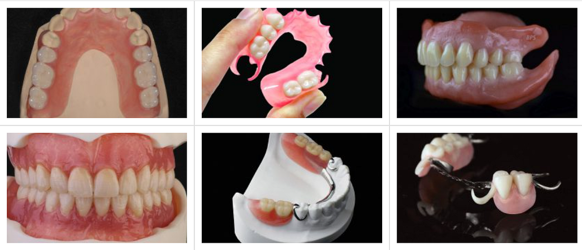 Regaining Confidence and Function: A Guide to Removable Dentures | by ...