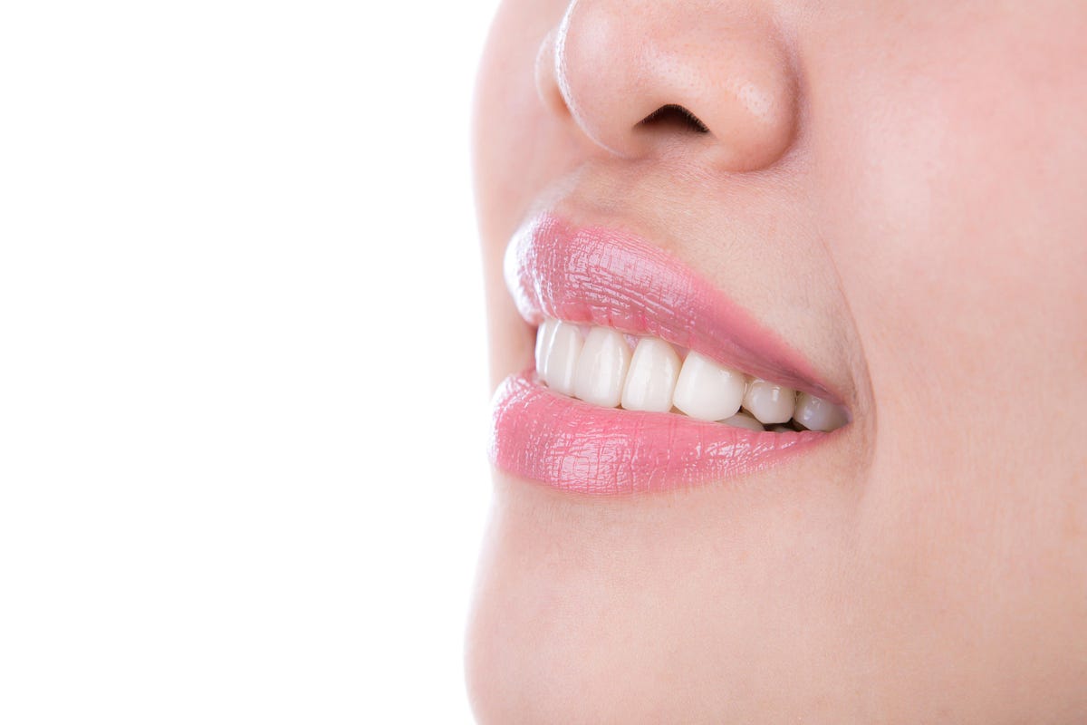 How Teeth Whitening Can Help Illuminate Your Smile | by Harry | May ...