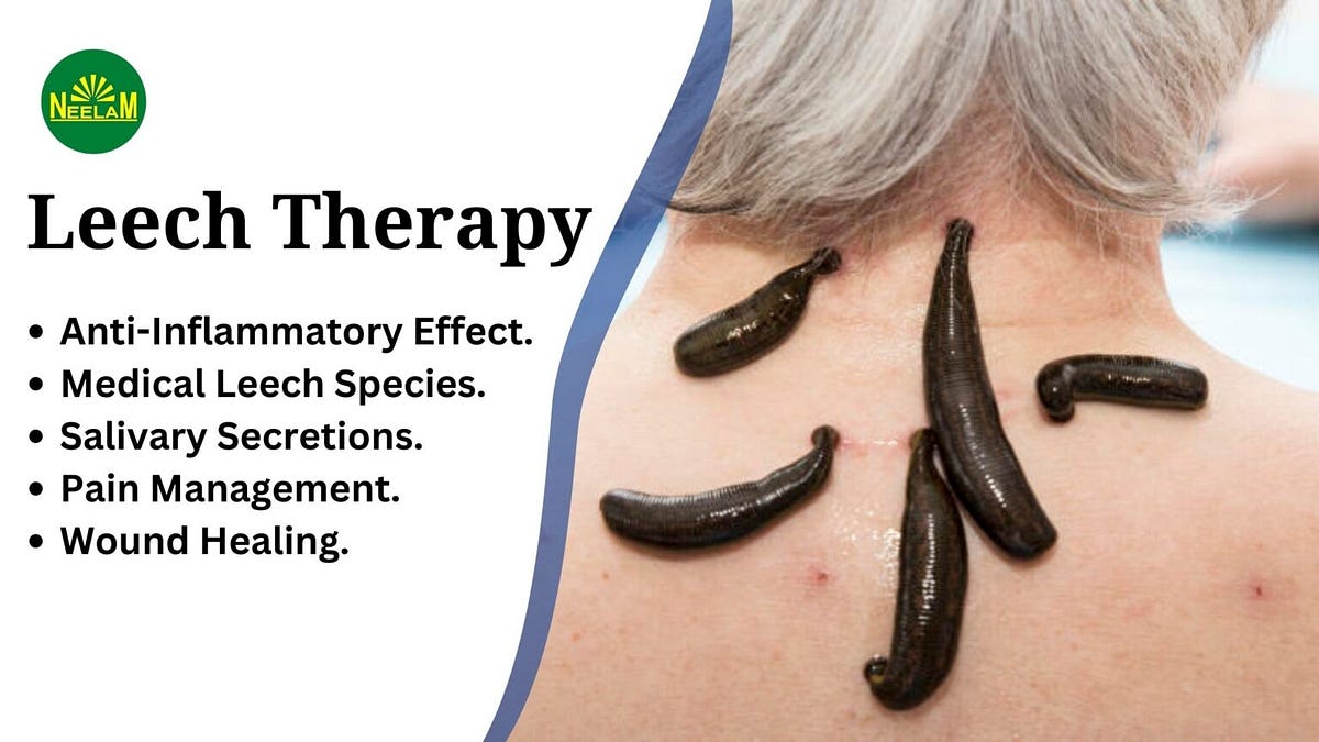 Leech Therapy in Delhi. Leech Therapy in Delhi | by Neelam Dawakhana ...