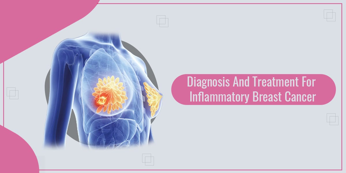 DIAGNOSIS AND TREATMENT FOR INFLAMMATORY BREAST CANCER - Dr. Mark D ...