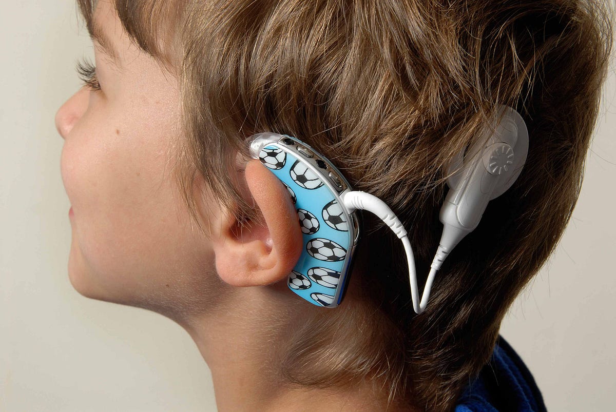 Technology Is Helping The Deaf Hear, But at What Cost? | by Shira Rubin ...
