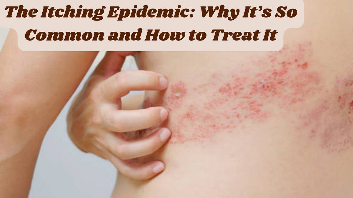 The Itching Epidemic: Why It’s So Common and How to Treat It | by ...