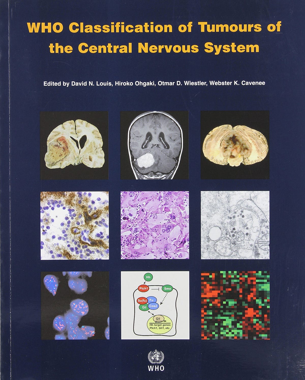 [EBOOK] WHO Classification of Tumours of the Central Nervous System ...