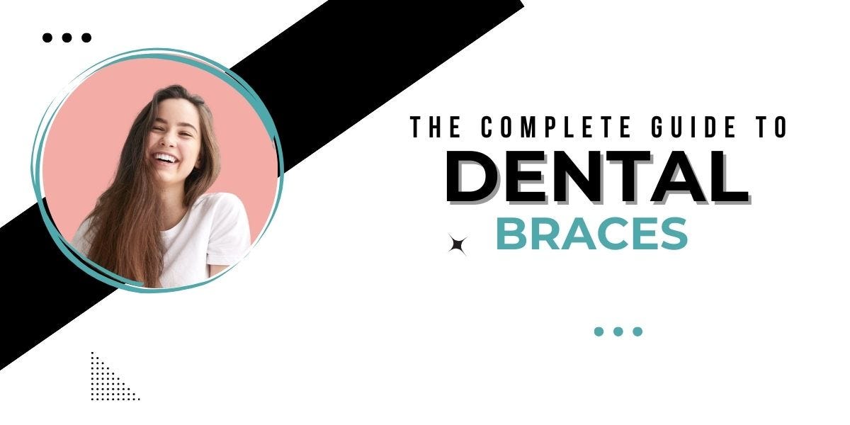 The Complete Guide to Dental Braces - Chatfield Dental Braces - Medium