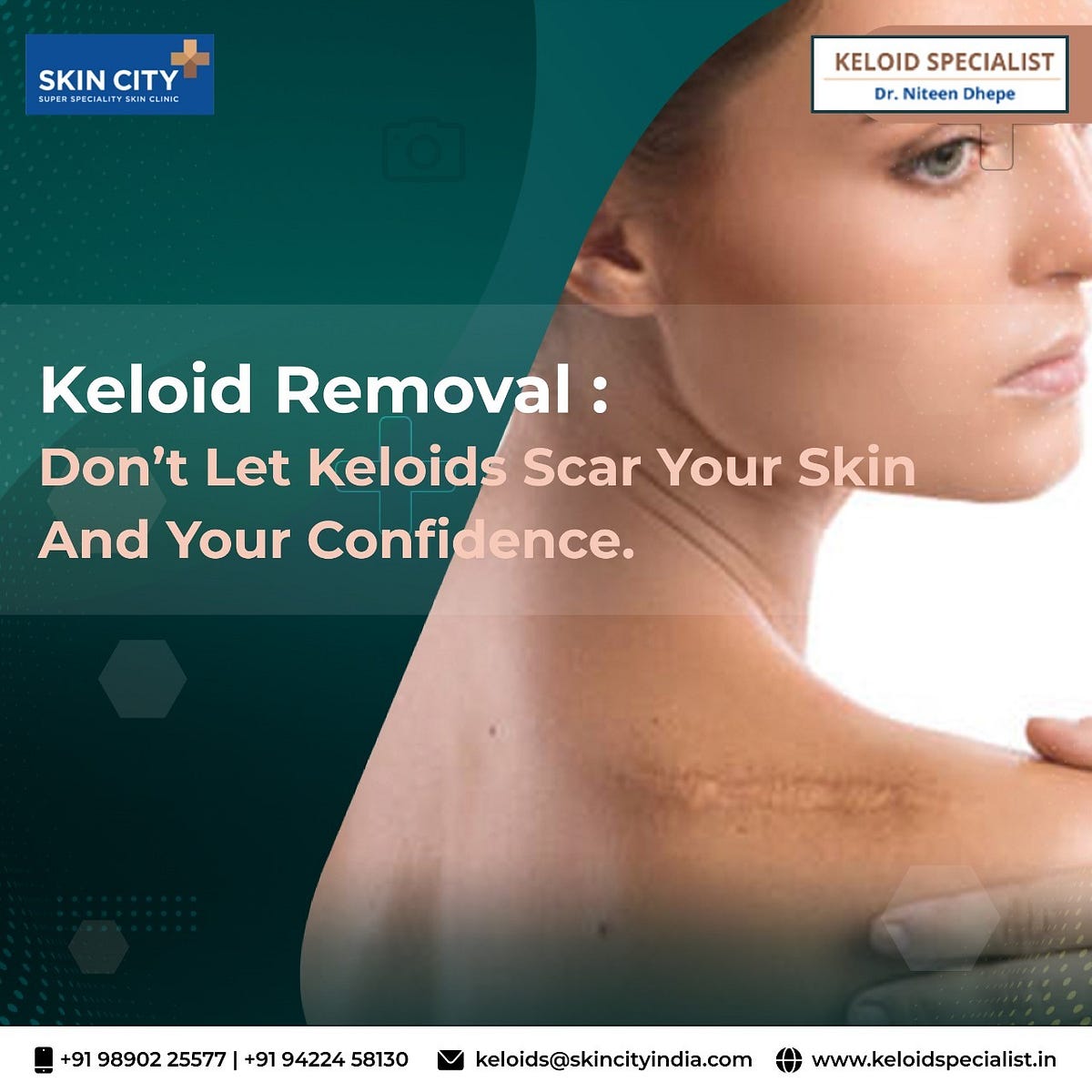 Keloid Doctor in Pune - Keloidspecialist - Medium