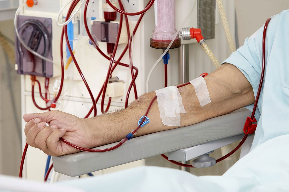 Innovations in Dialysis Technology: The Future of Renal Care | by ...