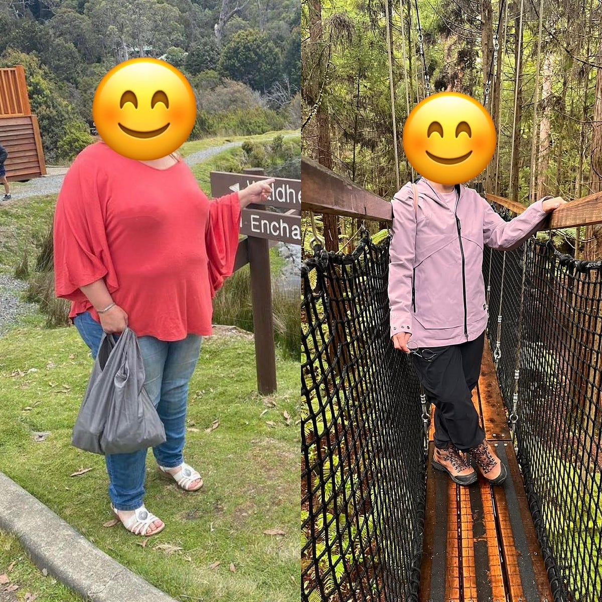 I’m Not Fat Anymore, Thanks to Bariatric Surgery | by Matilda Fairholm ...