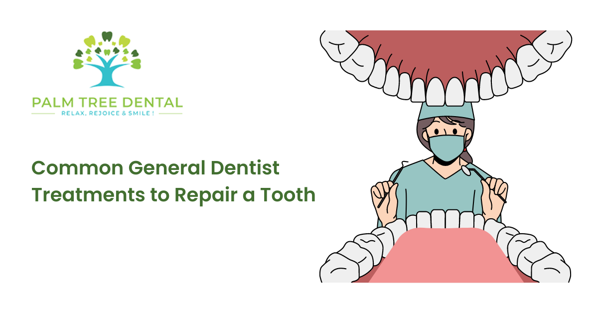 Common General Dentist Treatments to Repair a Tooth | by Palm Tree ...