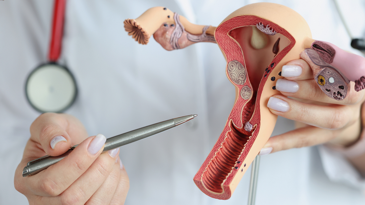 Revitalizing Womens Health Uterine Polyp Removal Surgery At Audubon