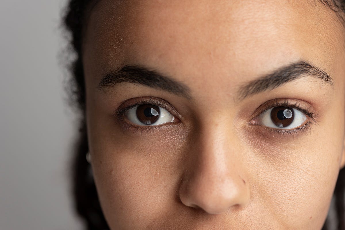 Understanding Under Eye Circles: The 3 Types and Solutions | by Isadora ...