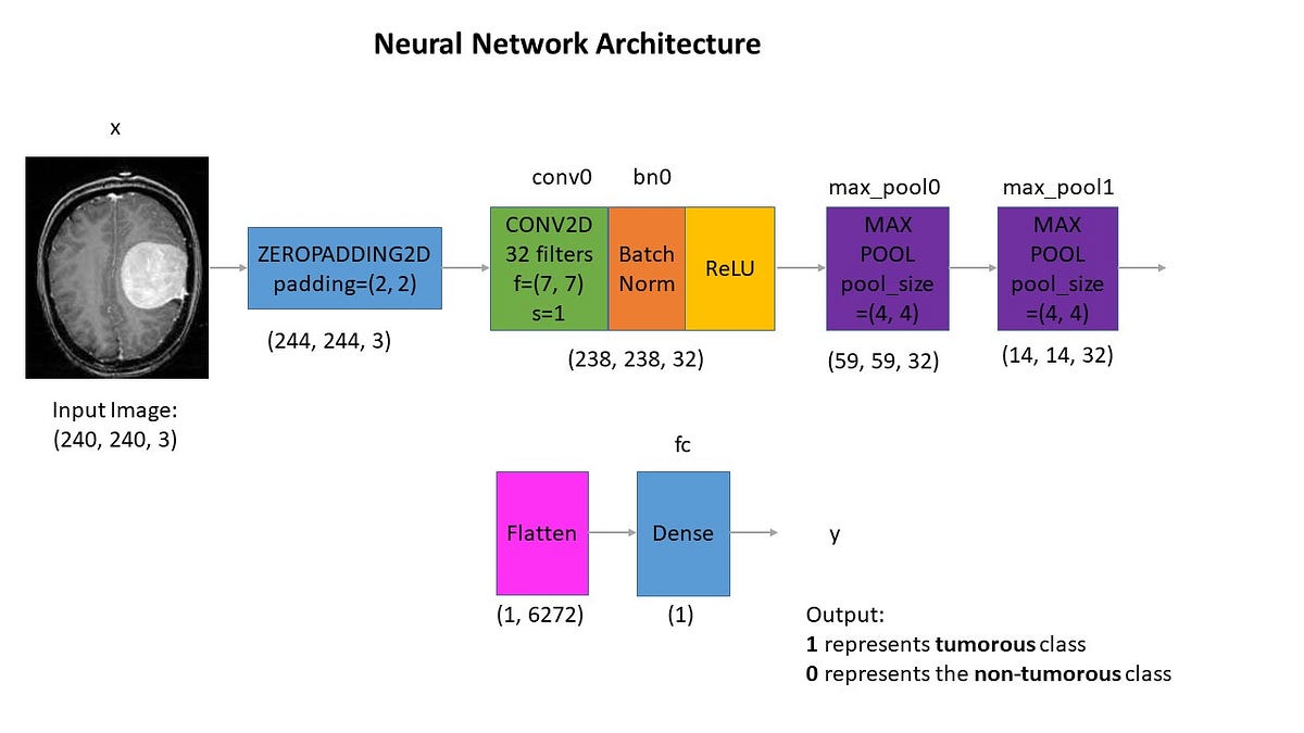 Brain Tumor Detection Using Convolutional Neural Networks | by Mohamed Ali Habib | Medium