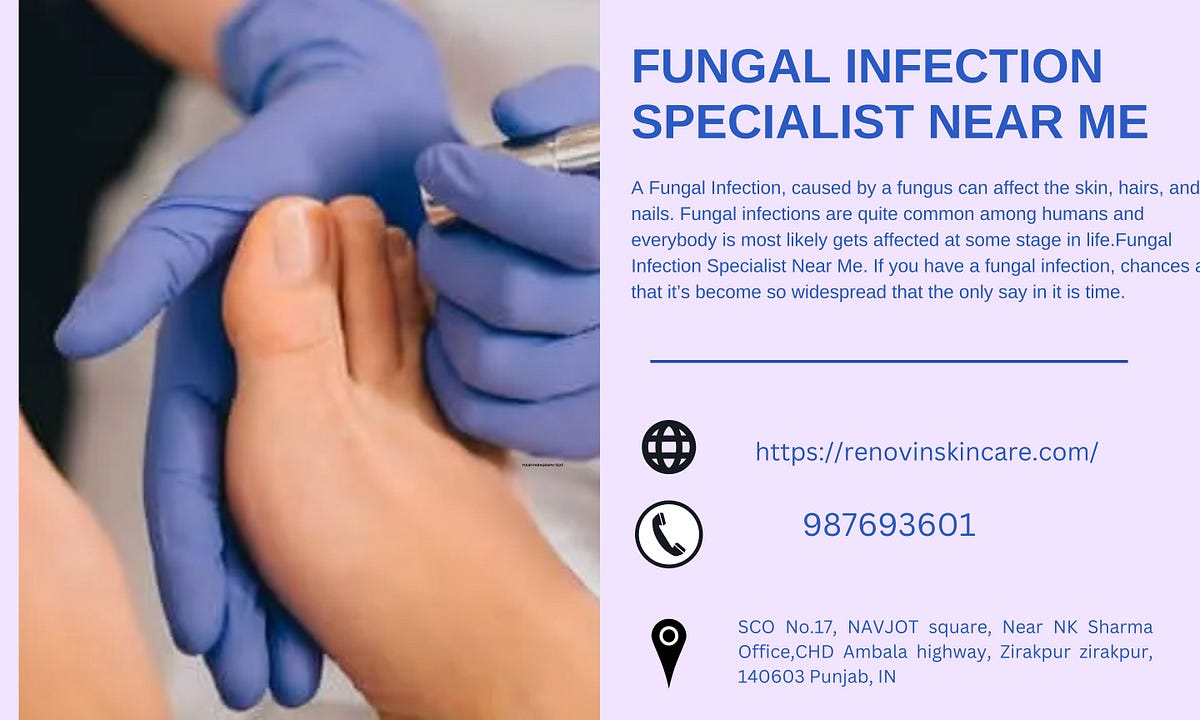 Fungal Infection Specialist Near Me | by Renovin Skin Care | Medium