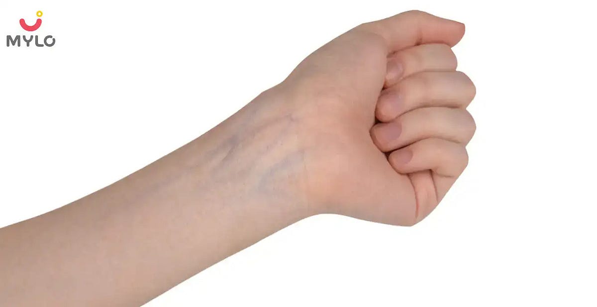 What is a Veiny Hands? - Neha Sharma - Medium