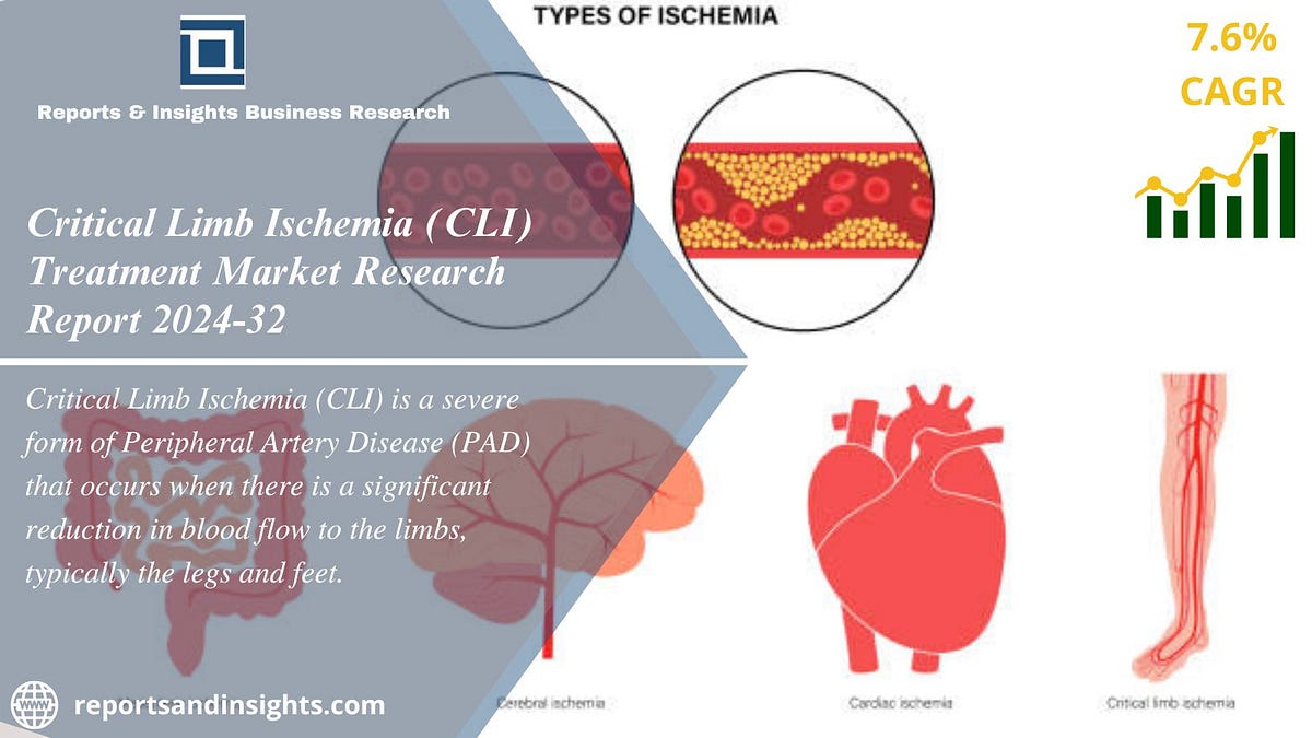 Critical Limb Ischemia Treatment Market Size, Share 2024–2032 | by ...