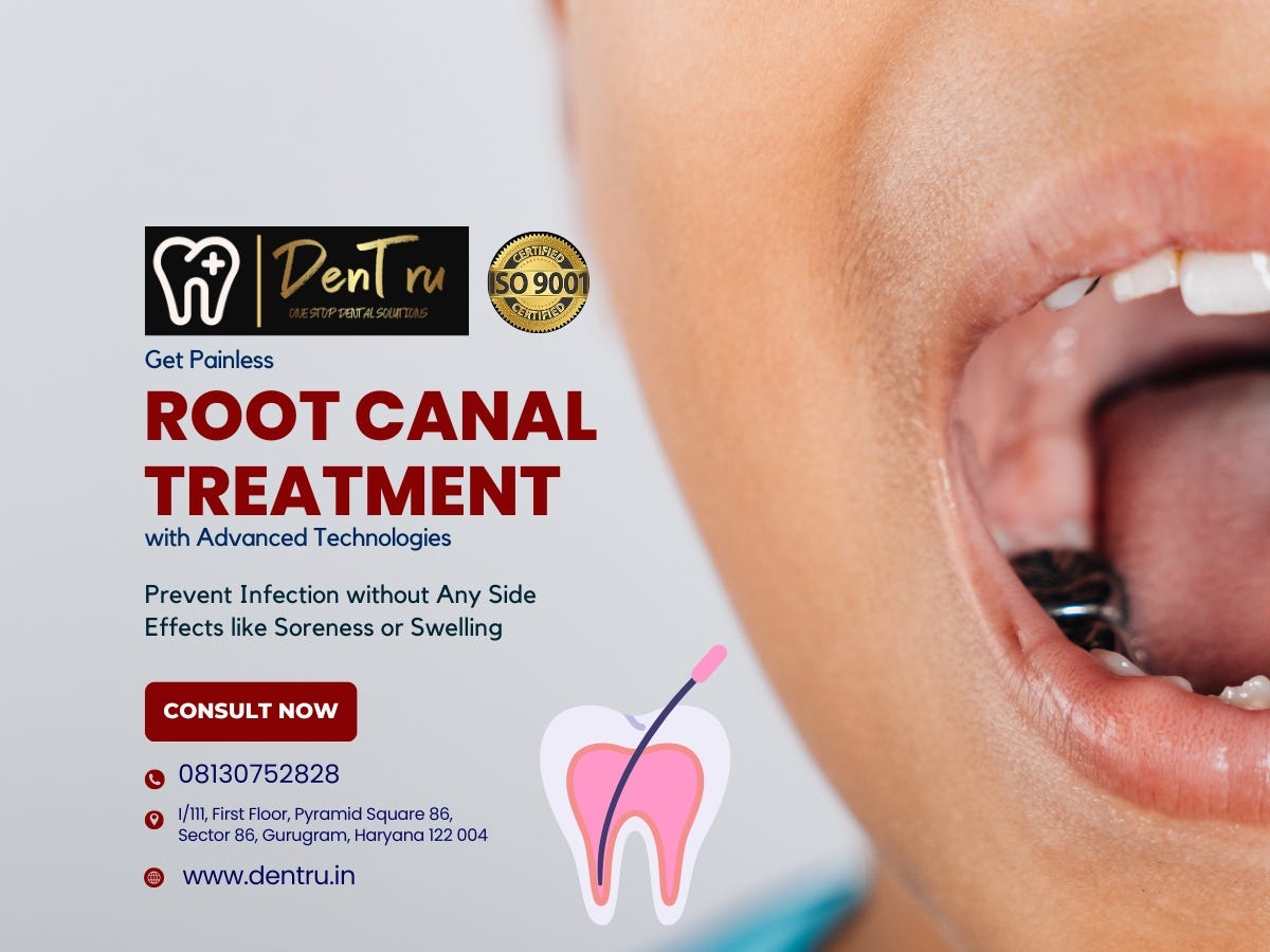 Painless Root Canal Treatment in New Gurgaon | by Dentru Oral and Dental Wellness Clinic | Mar ...