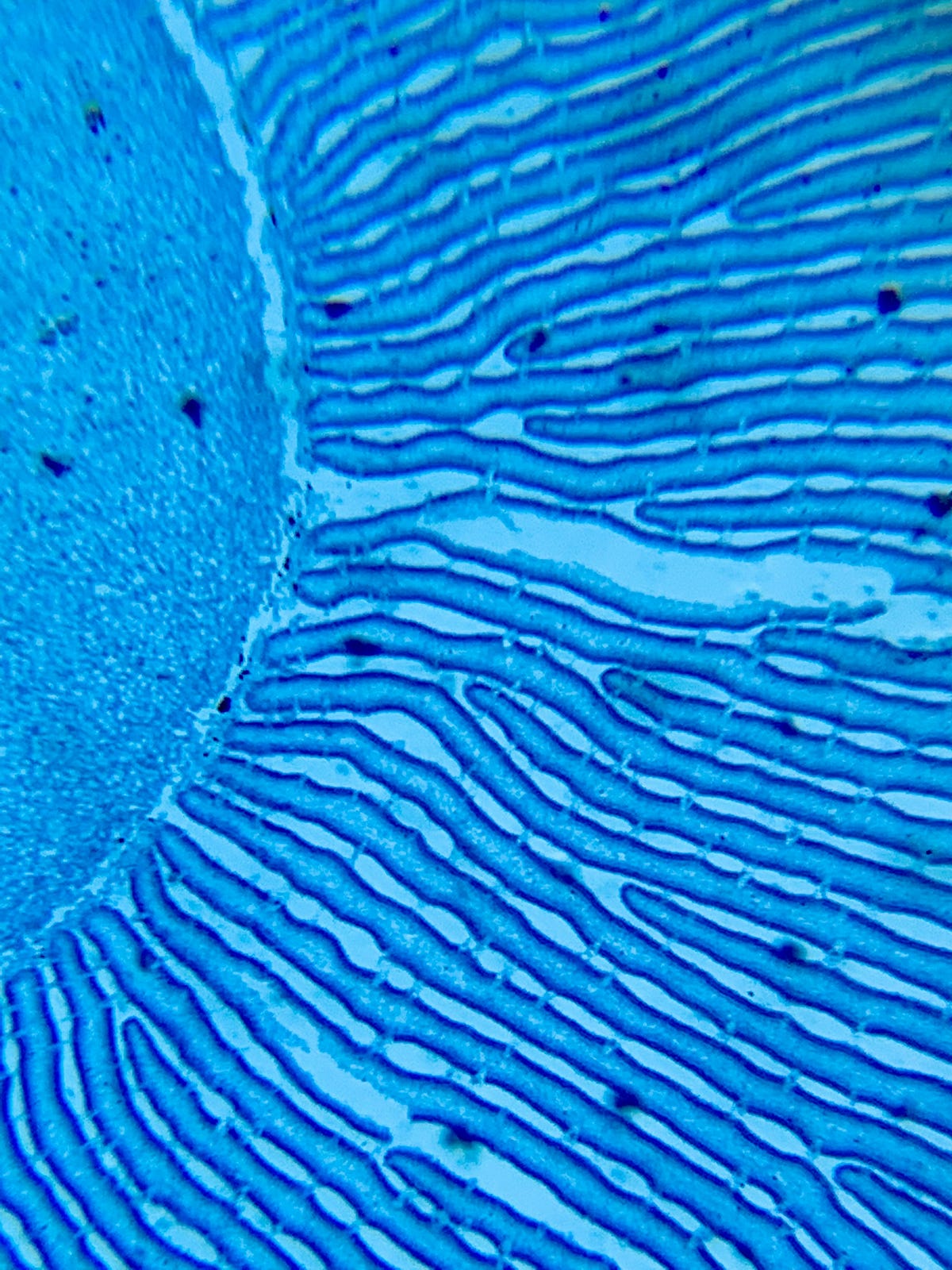 Beyond the Microscope: How Biophysics is Revolutionizing the Fight ...