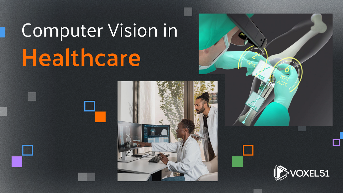 How Computer Vision Is Changing Healthcare in 2023 | by Jacob Marks, Ph ...