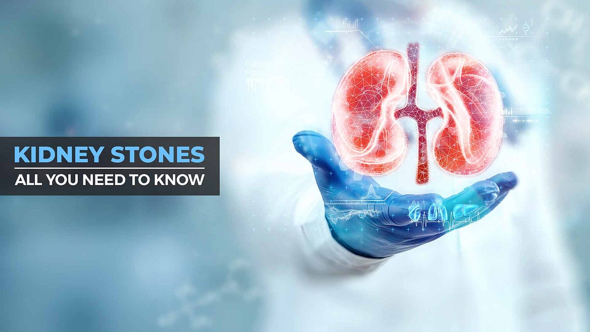 Kidney Stones: Causes, Symptoms, and Prevention Tips | by Rehan Asghar ...
