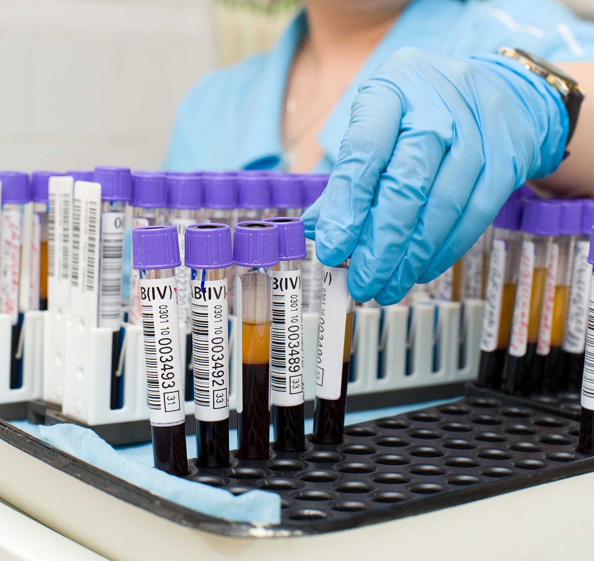 Bilirubin Colorimeter Assay Is A Clinical Device That Is Used To Measure The Concentration Of