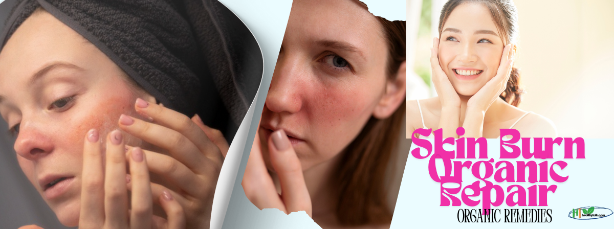 Discover organic remedies to heal skin burn organic repair naturally ...