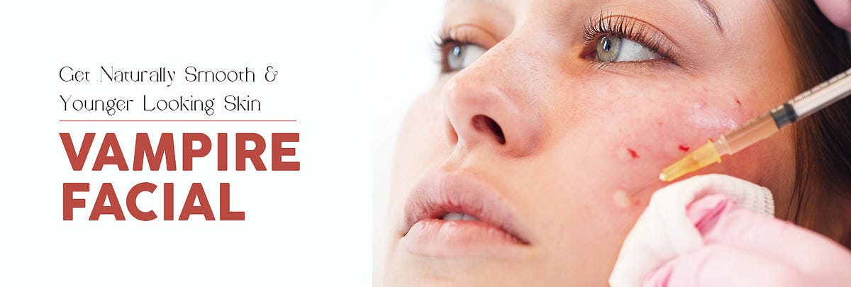Discover the Benefits of Vampire Facials | by Arthskin and fitness ...