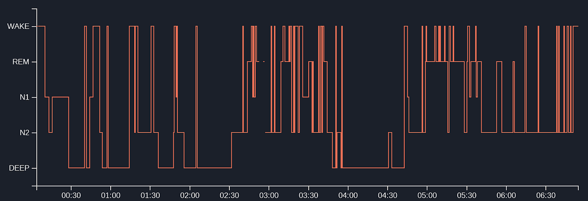 How to Create a Hypnogram in Swift? | by Adrien Catanas | Medium