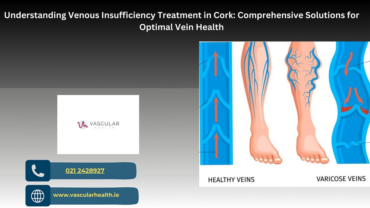 Understanding Venous Insufficiency Treatment In Cork Comprehensive