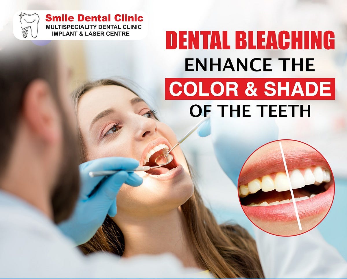 Best Dentist For Teeth Bleaching In Indore | Smile Dental Clinic — Dr ...