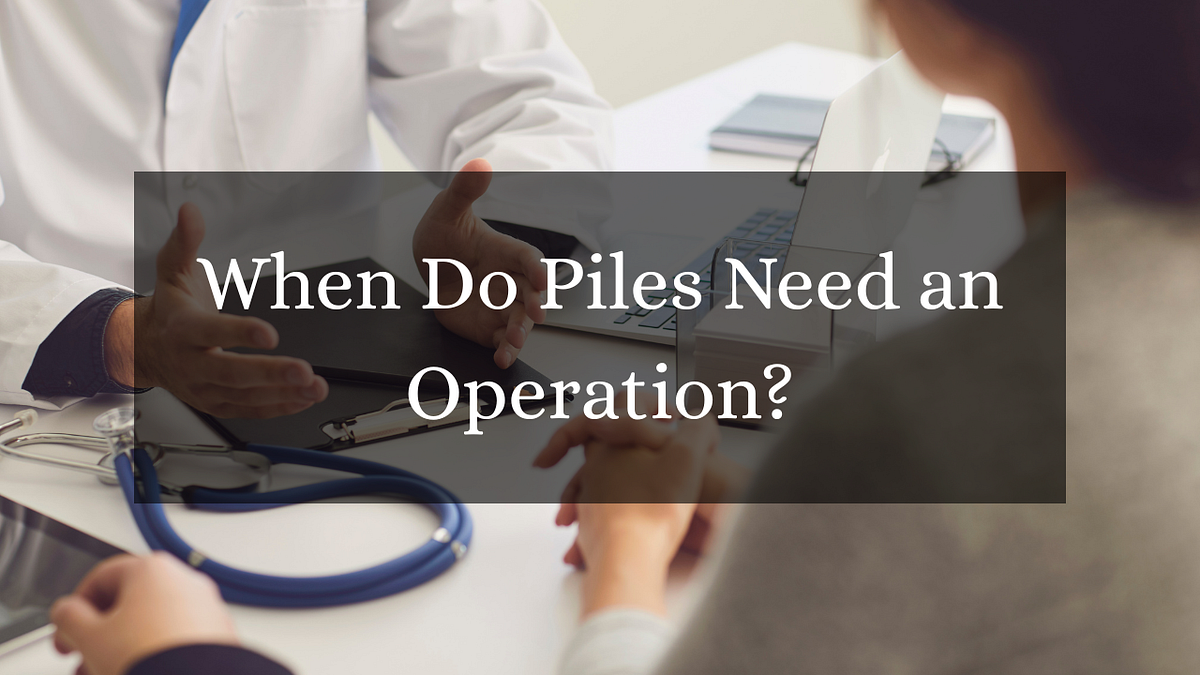 When Do Piles Need an operation?. Piles, also known as hemorrhoids, are ...