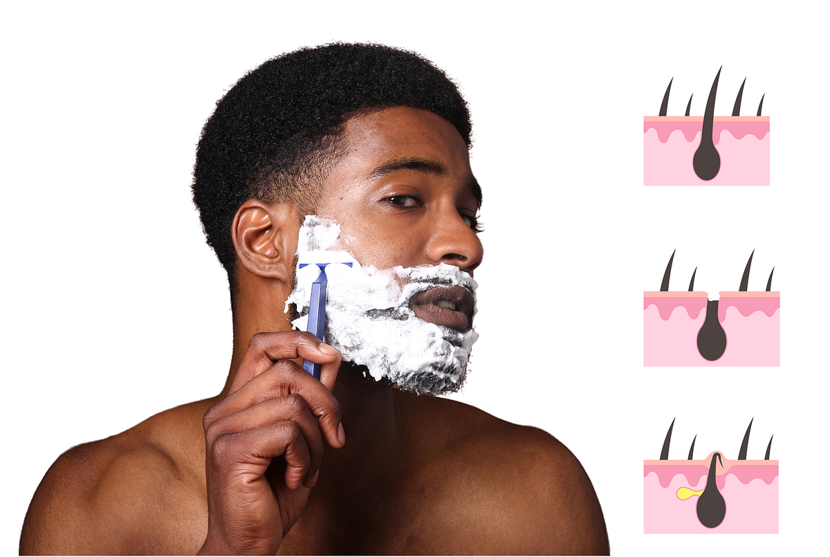 Are Razor Bumps Ruining Your Morning Shave? | by Annie Foley | Aha ...