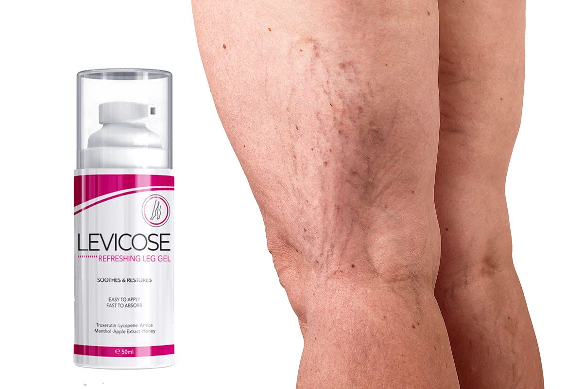 Levicose : La Solution Naturelle pour Combattre les Varices et ...