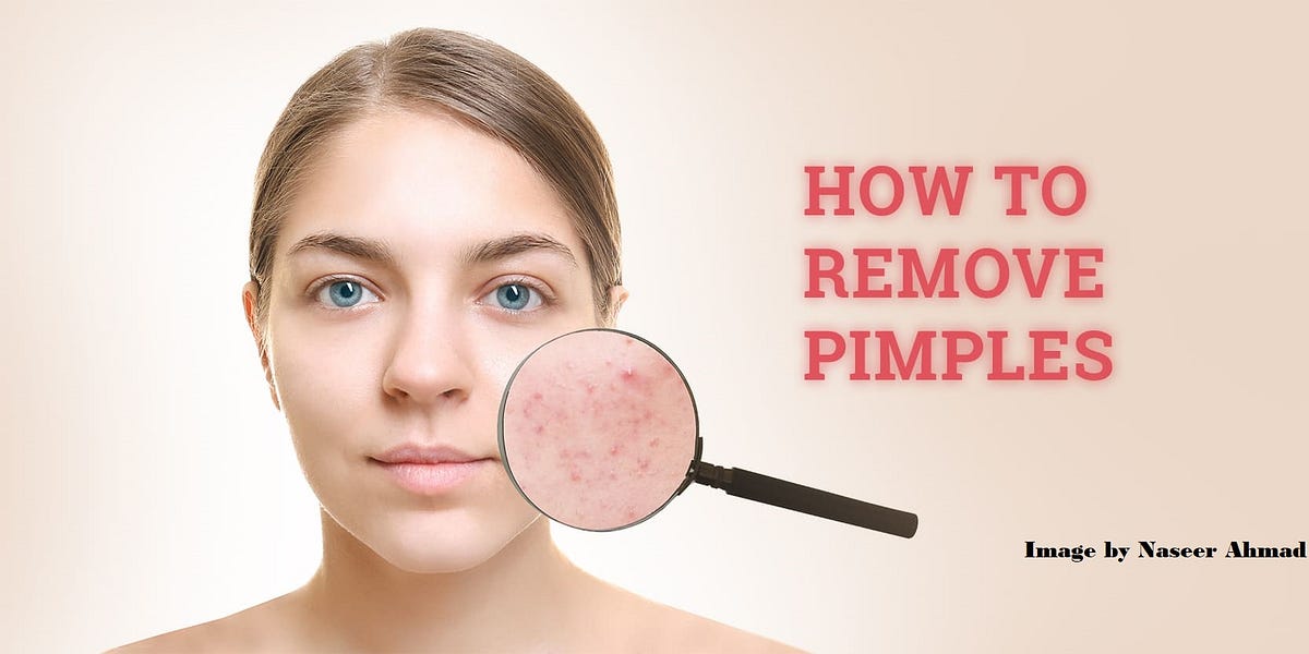 Effective Tips to Get Rid of Pimples and Pimple Marks | by Naseeer ...