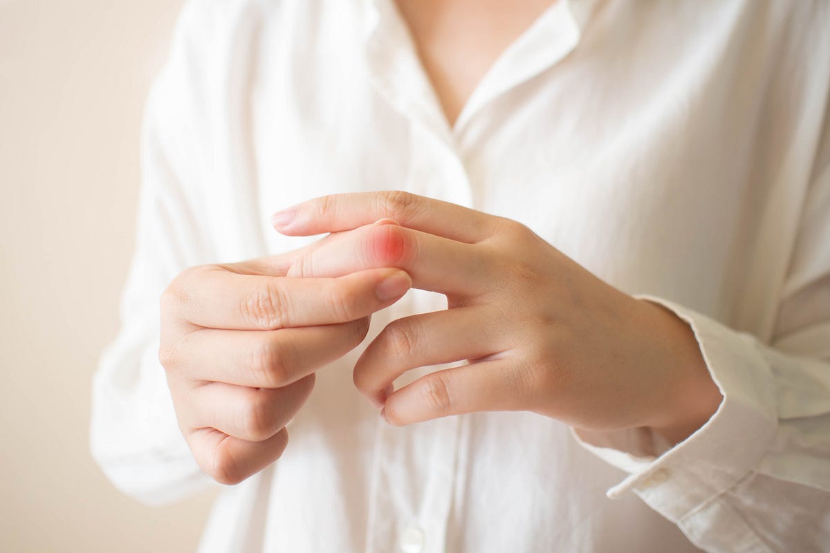 Lupus disease and the gut microbiome | by ENBIOSIS Biotechnology | Medium