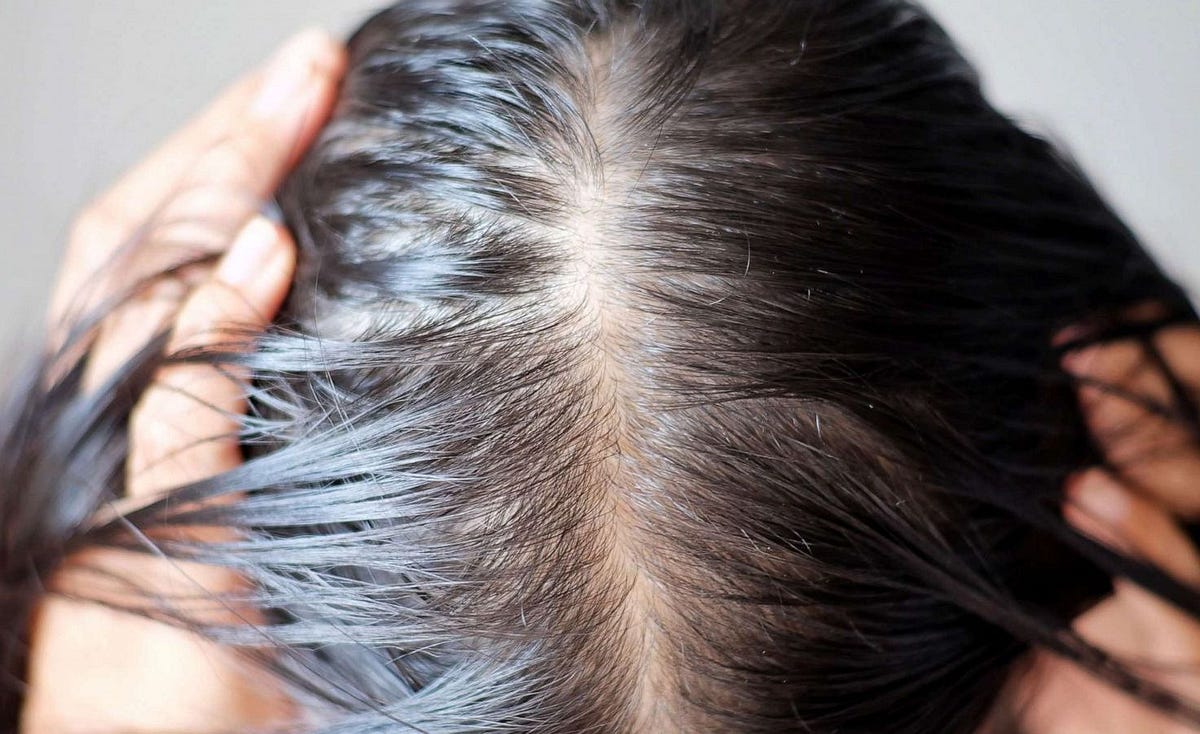 Women hair common diseases. There are several common hair diseases that ...