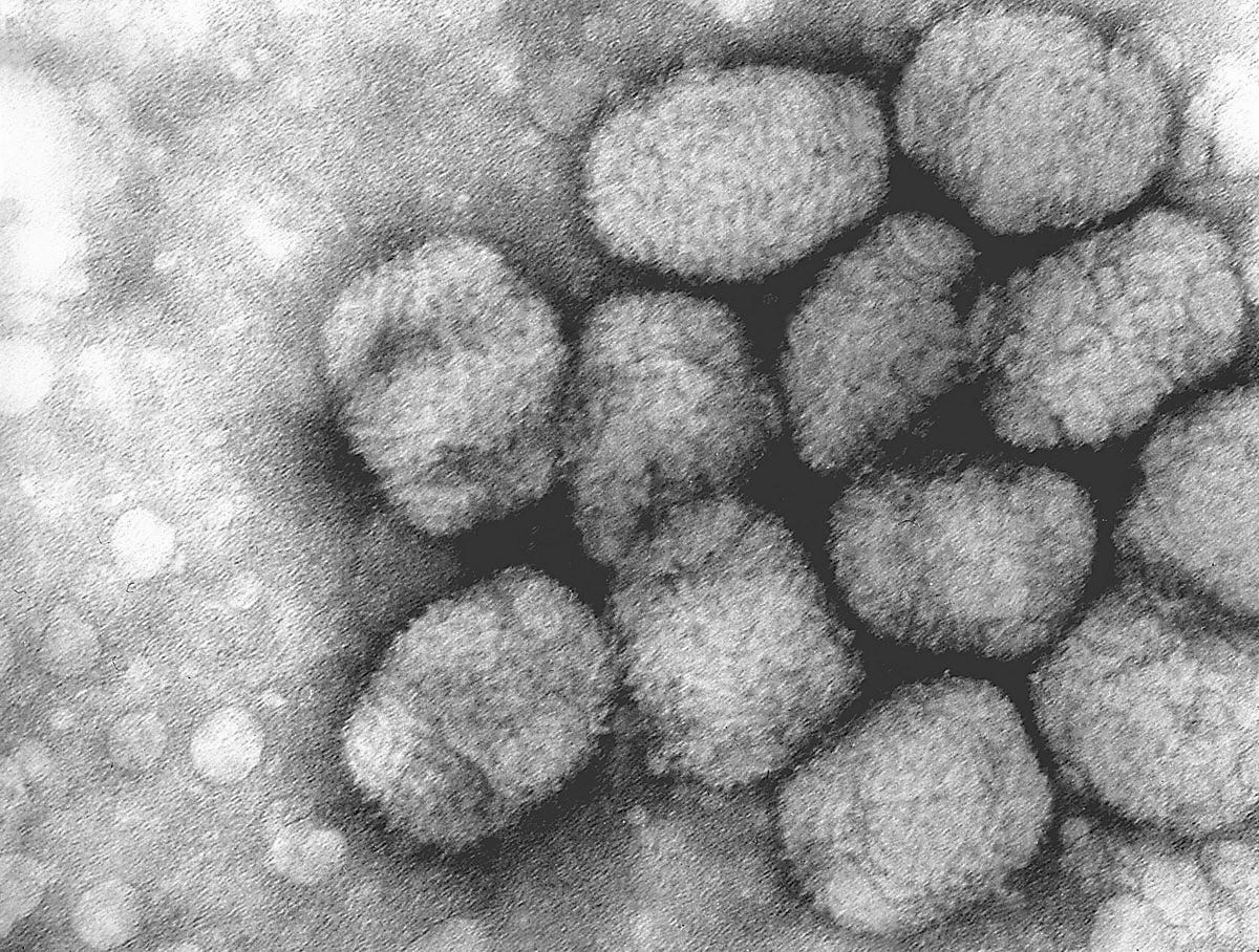 The Last Victim of the Red Plague | by Julie Estep | Medium