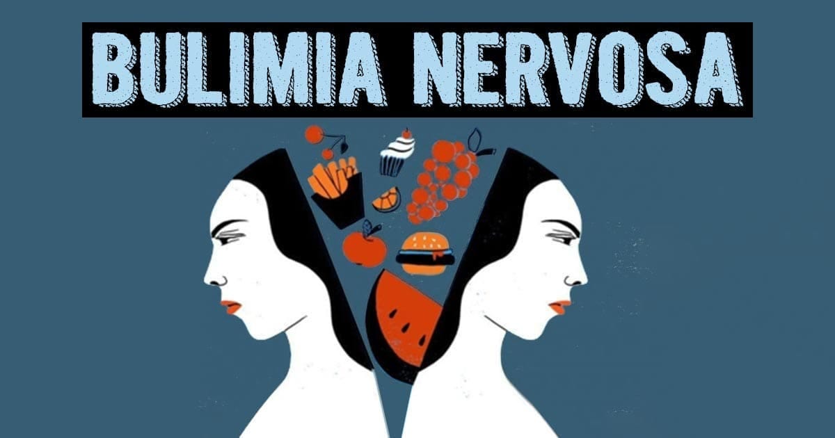 Bulimia Nervosa. Bulimia nervosa is a serious eating… | by Mind Help ...