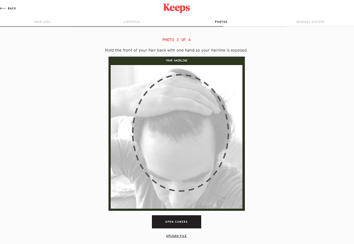 How Keeps Became the Biggest DTC Hair Loss Brand | by Thirty Madison ...