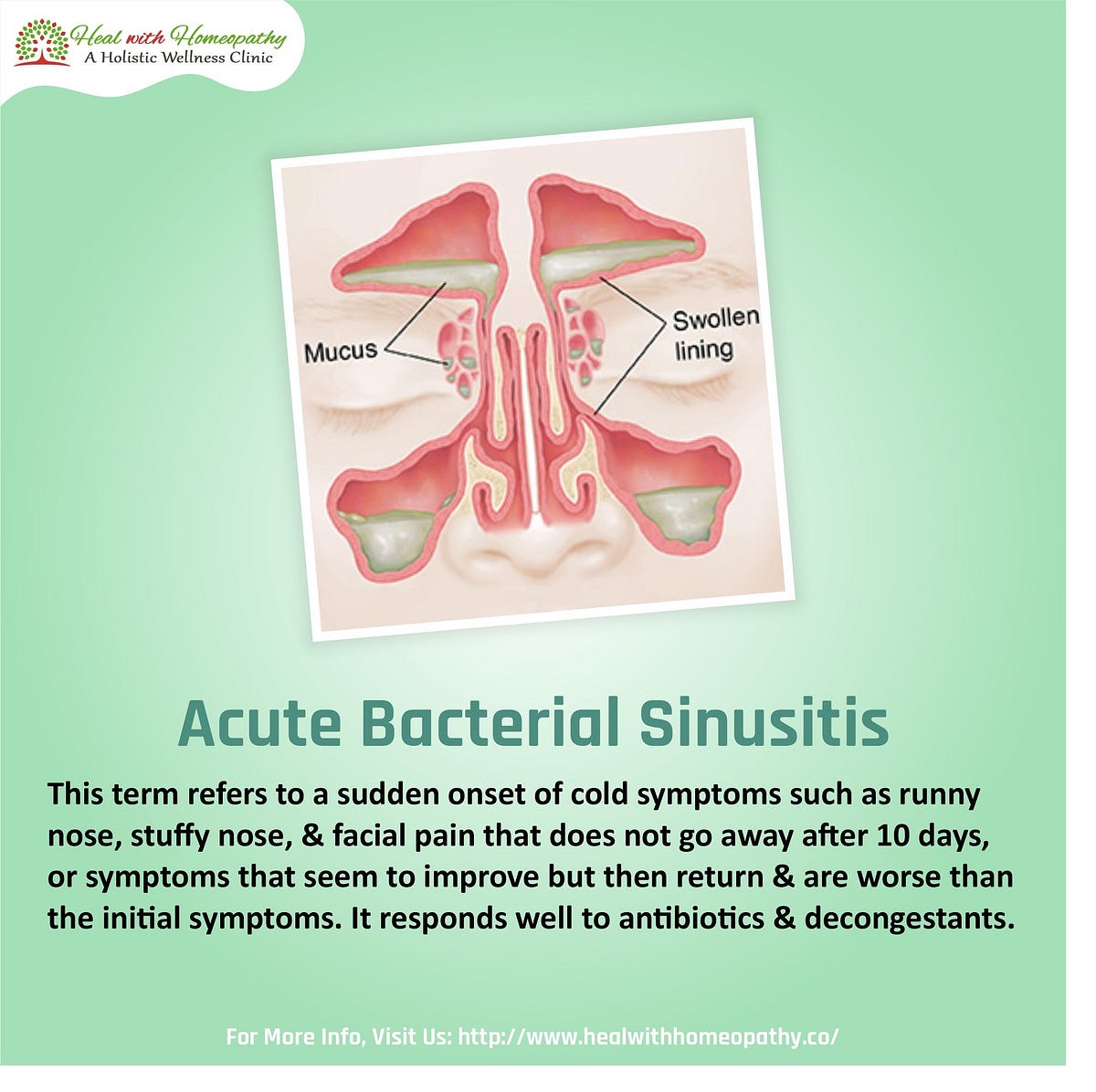 Types Of Sinusitis Dr Geeta Rani Arora Medium