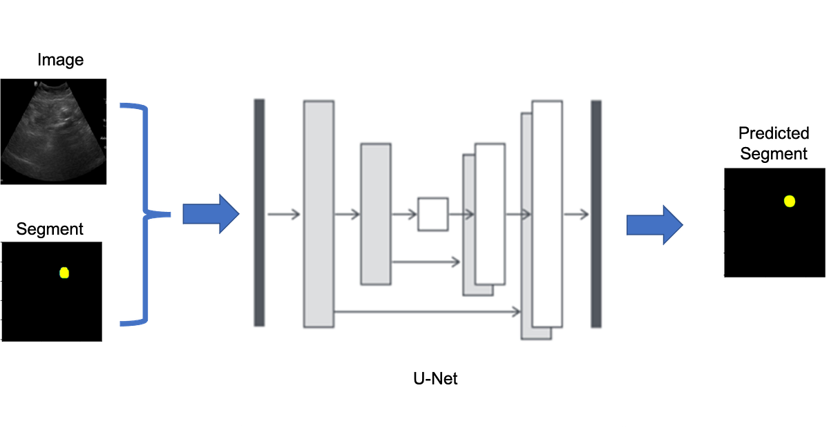 A Comprehensive Guide to UNet Implementation with TensorFlow | by Sumit Pandey | Towards Deep ...