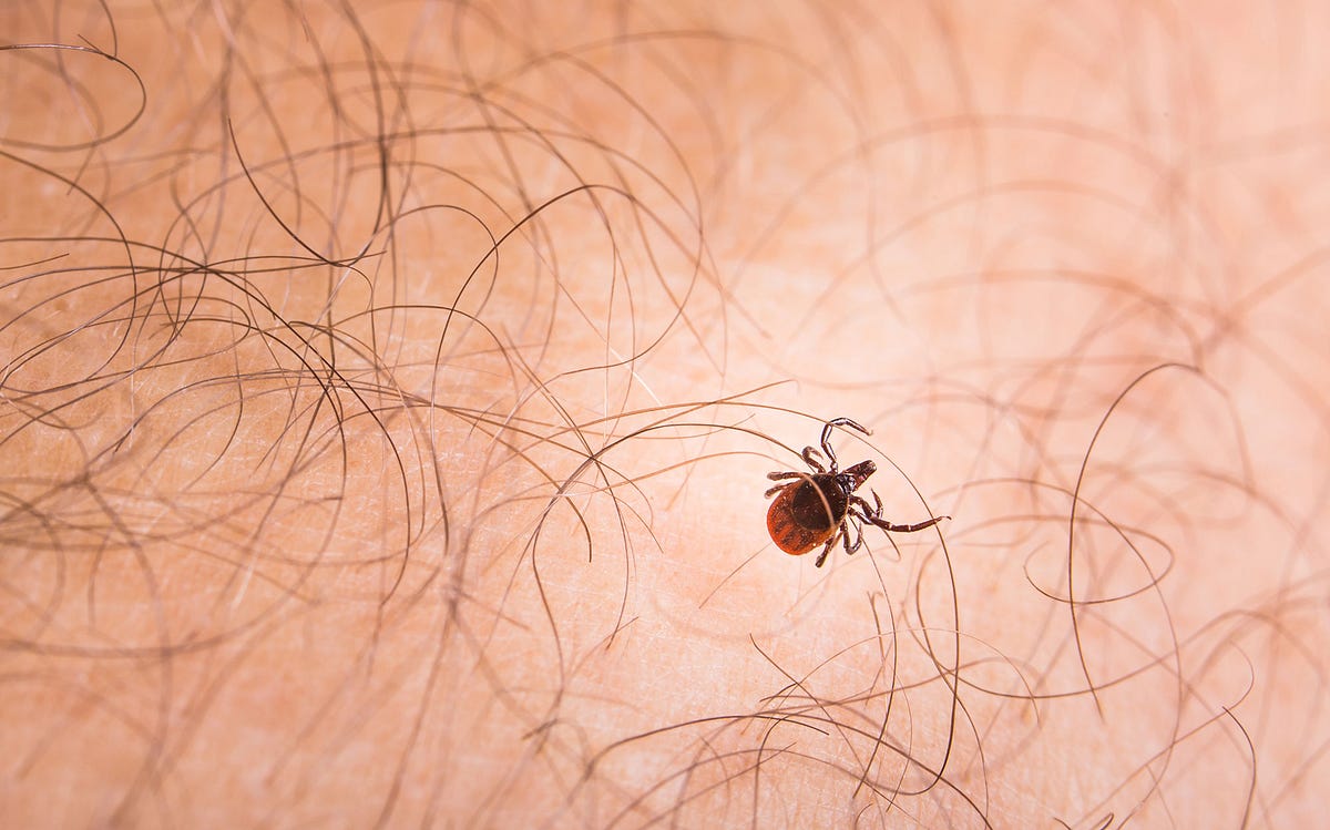Preventing Lyme Disease After Tick Bites: A Comprehensive Guide | by ...