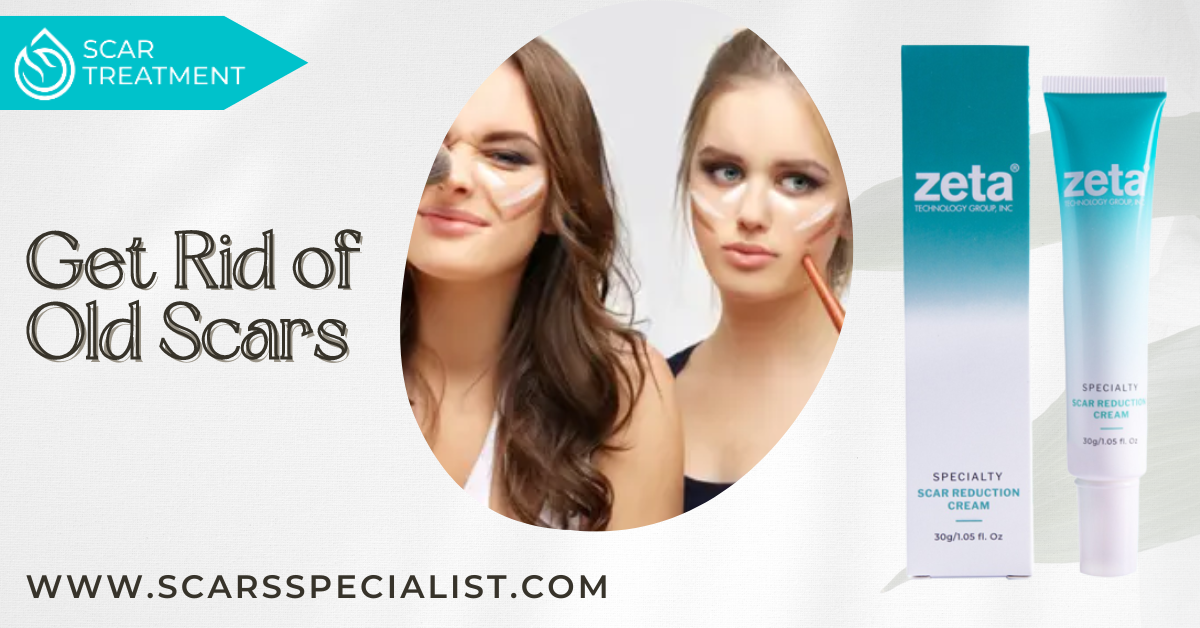 What is the Natural Scar Treatment for Acne? — Scar Treatment | by Scar ...