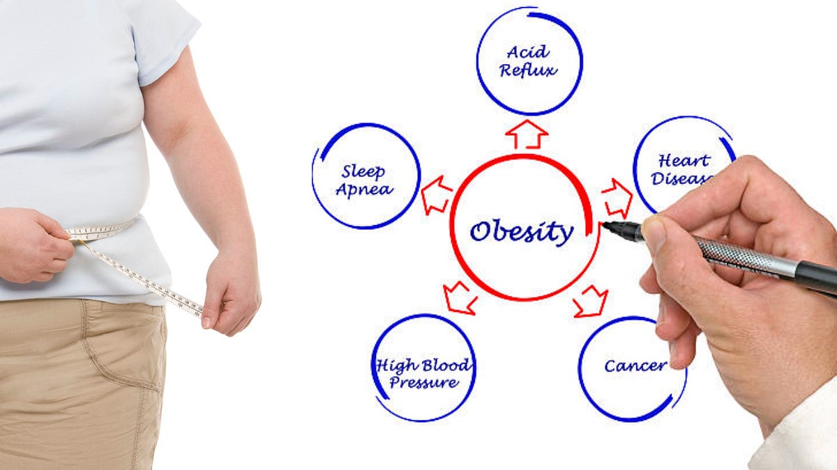 Preventing Obesity: Tips and Strategies for a Healthier Lifestyle | by ...