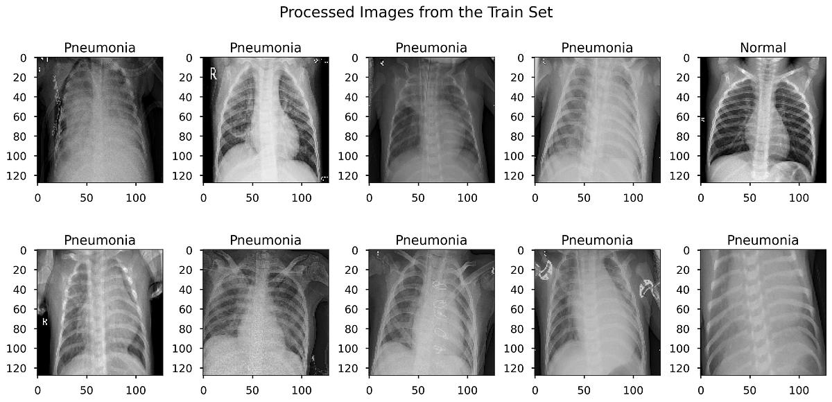 Transfer Learning with ResNet50V2 Made Simple | by Aysu Erdemir | Medium